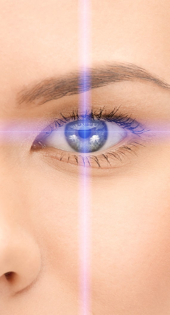 Laser Eye Surgery Consultation | North York
